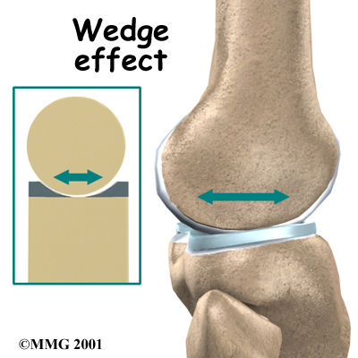 Peak your Performance - Blog: Peak Performance Physical Therapy
